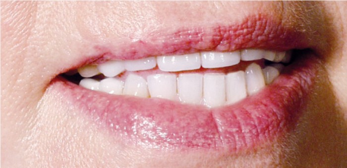 Narbenüberzeichnung : Permanent Make up – Augenbrauen, Lidstrich ...